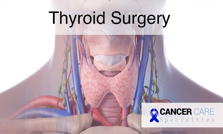 Cancer Care Specialties offers Minimally Invasive Thyroid Surgery ...