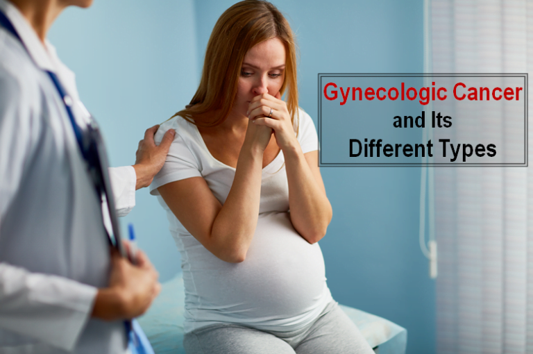 Gynecologic Cancer and Its Different Types