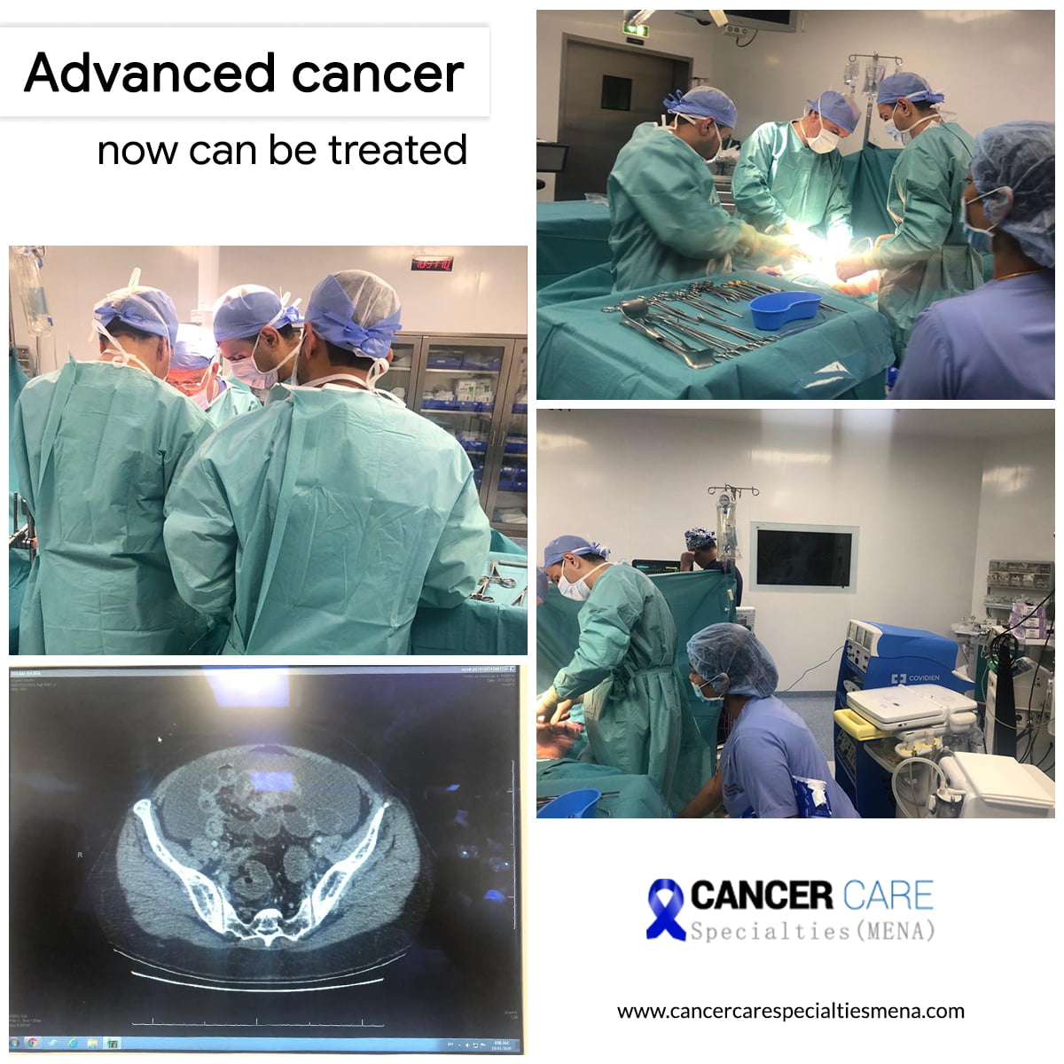 Advanced cancer now can be treated | Cancer Care Center UAE