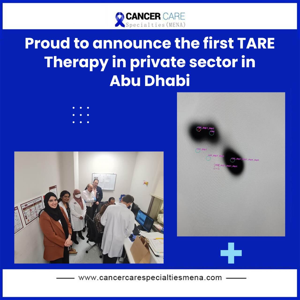 Proud to announce the first TARE therapy in the private sector in Abu ...