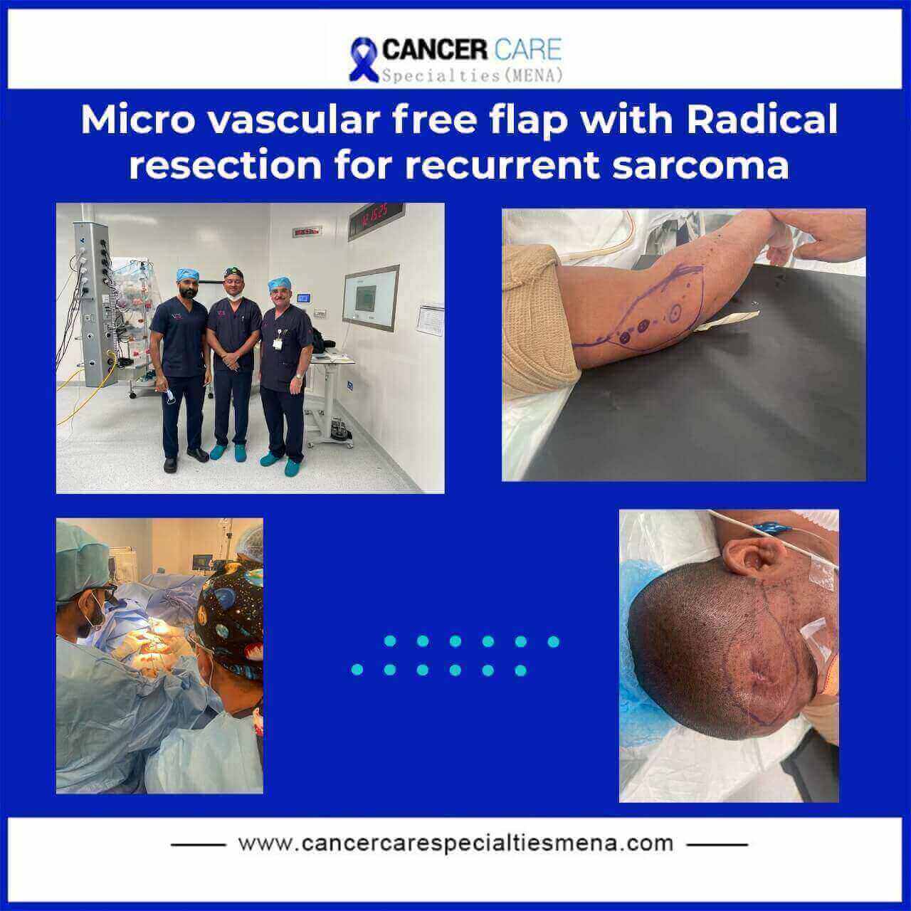 Micro vascular free flap with Radical resection for recurrent sarcoma ...