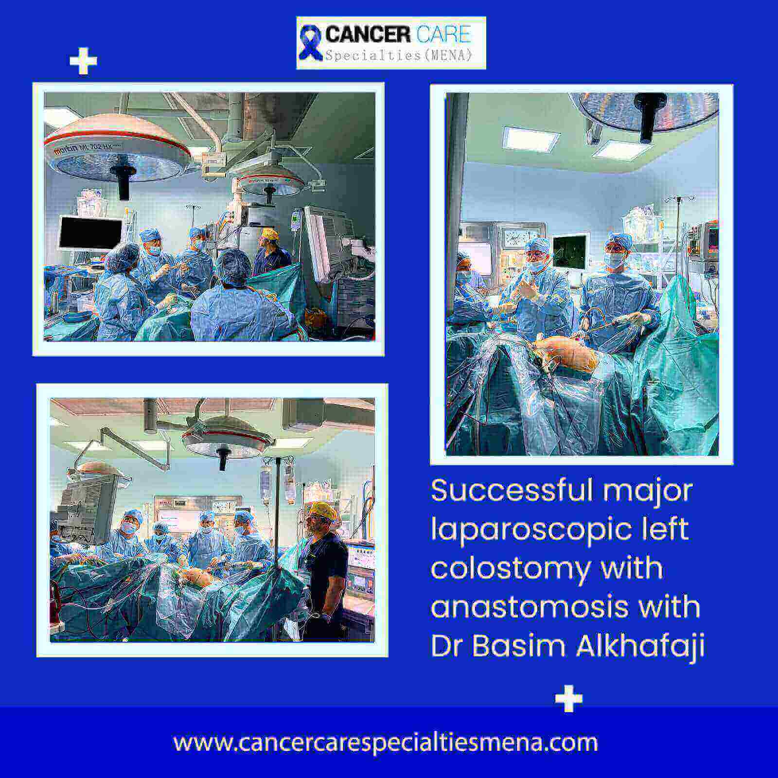 Successful major laparoscopic left colostomy with anastomosis with Dr ...