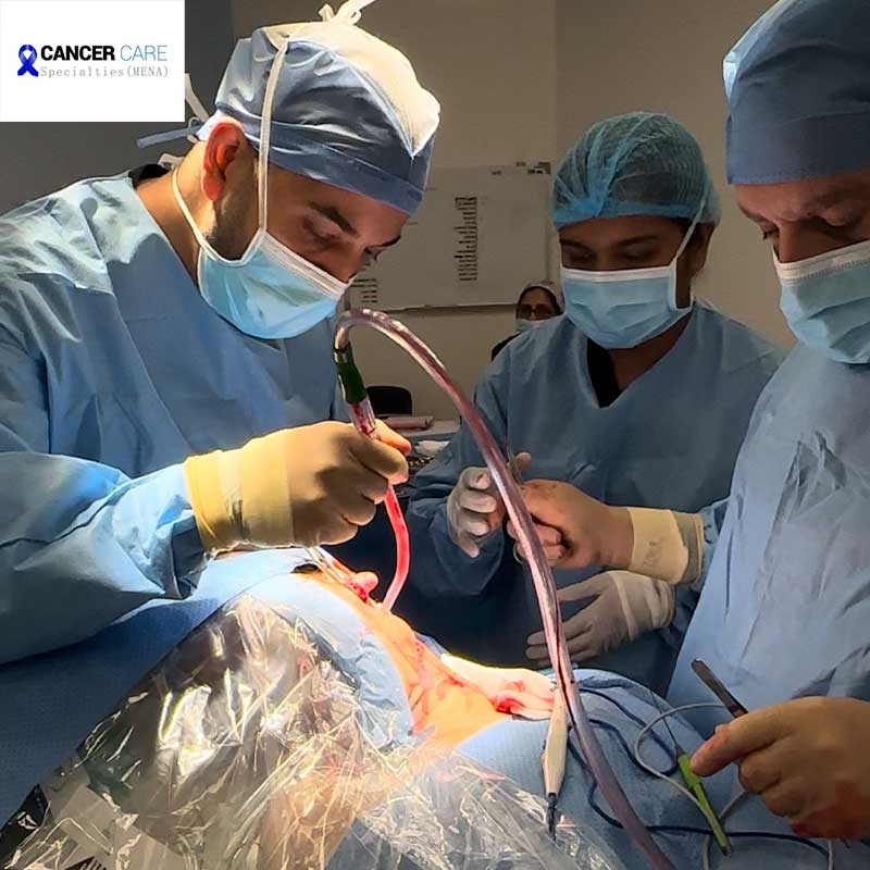 Parotid, Surgery in Middle East. | Cancer Care Center UAE